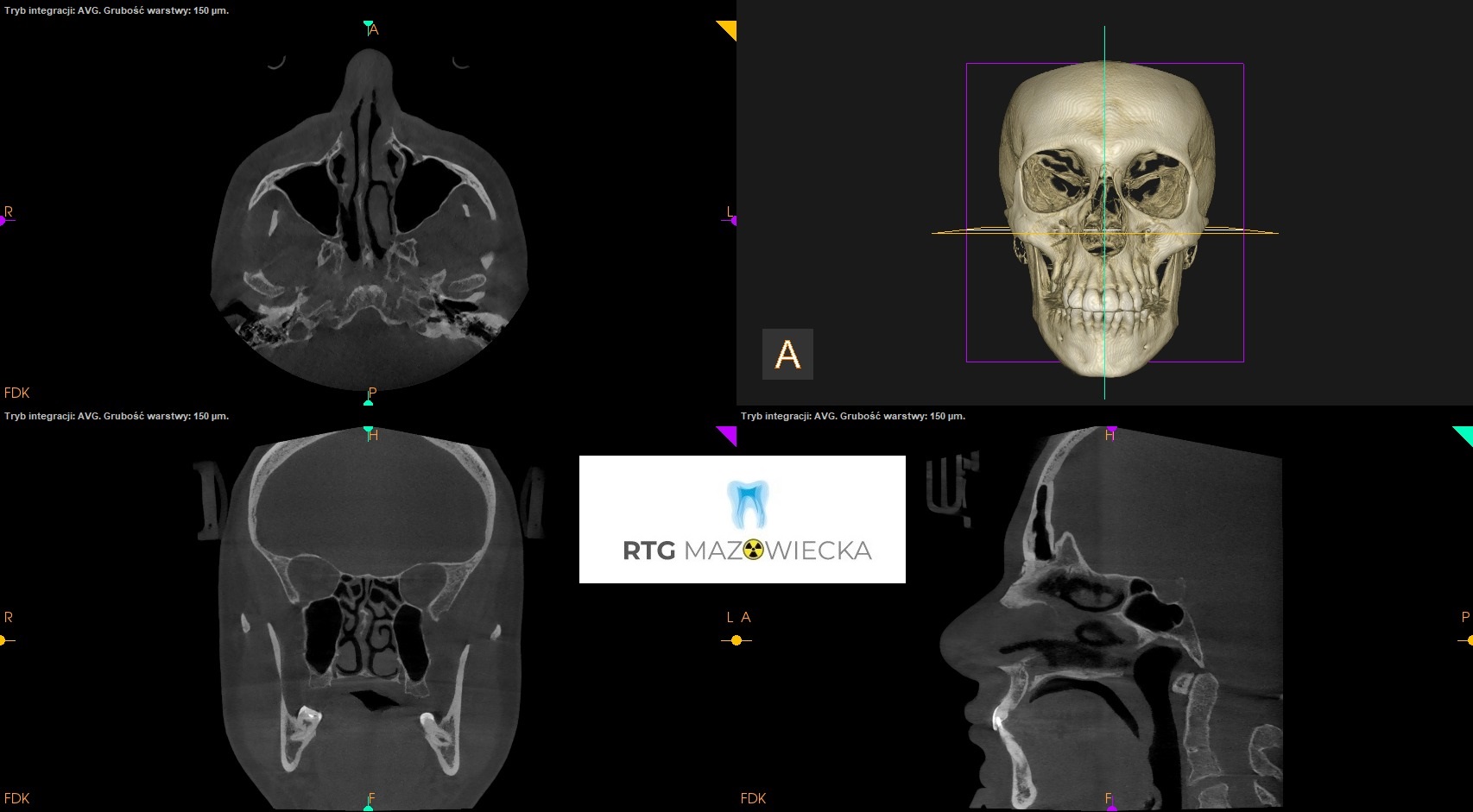 Tomografia stożkowa CBCT, tomografia szczęki Białystok, tomografia ...