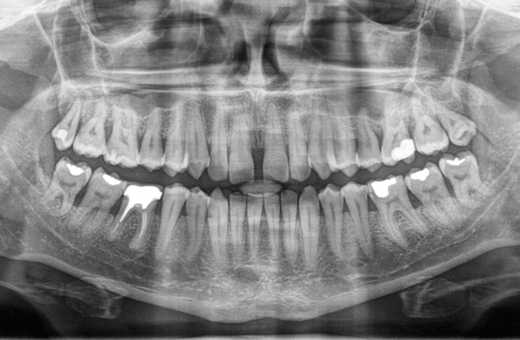 RTG Mazowiecka | Tomografia komputerowa zębów, zatok przynosowych ...